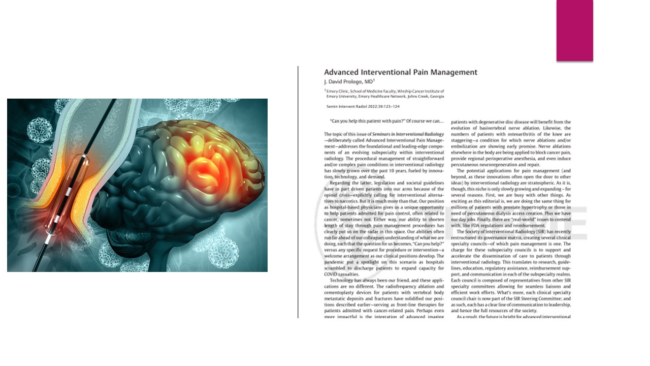 Advanced Interventional Pain Management - David Prologo - Working to ...